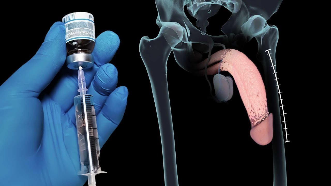 Giving Guys Boners Pics Of Guy With Raging Hardon After Male ...