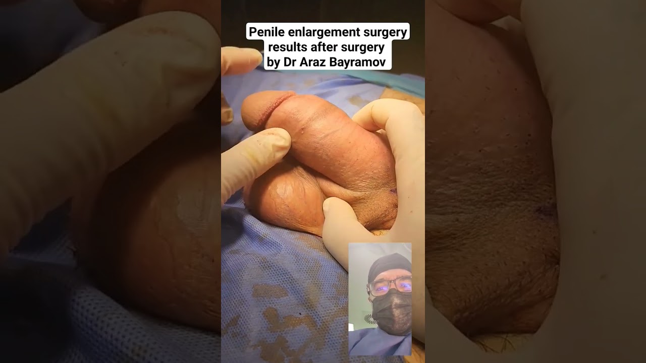 Does Generic Viagra Work The Same ：erectile Dysfunction Urine Flow