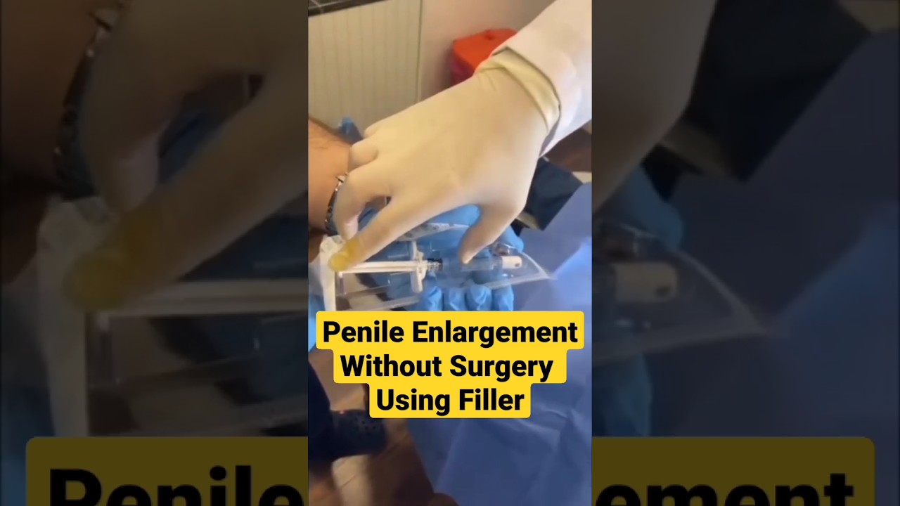 The Best 8 Ed Cures That Work