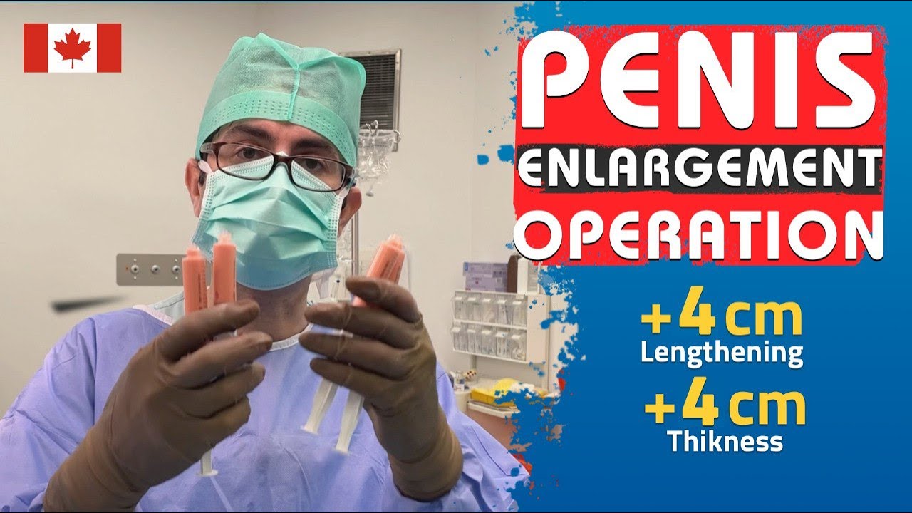 What To Do When Your Man Has Erectile Dysfunction