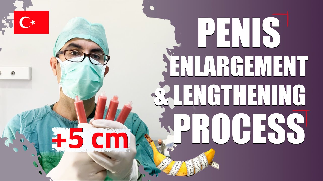 Can I Fix Erectile Dysfunction