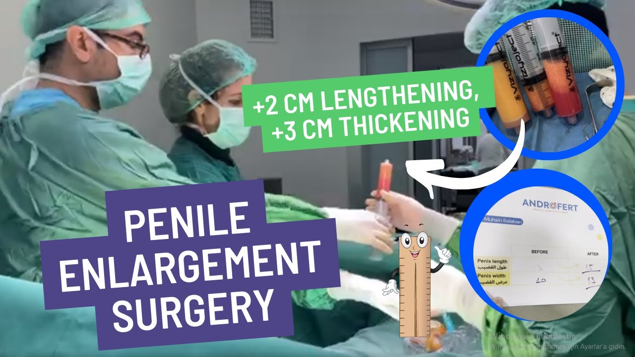 Vitamin World Male Enhancement Pills Enhancement Pills For Male Stores ...