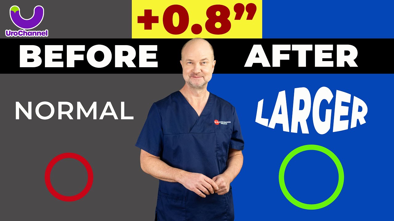 Cvs Male Enhancement Pills Serogen Reviews