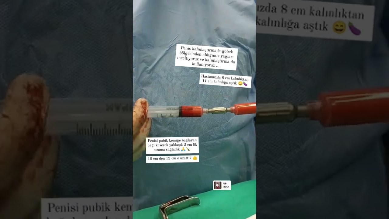 Erectile Dysfunction Injection In Pakistan